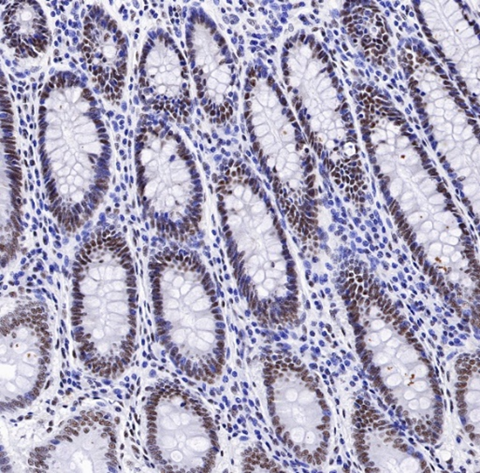TDP-43: A Double-Edged Sword in ALS Pathogenesis and ANT BIO PTE. LTD ...