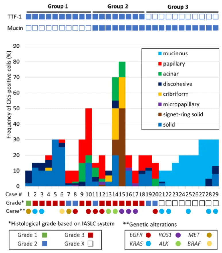 How does CK5/6 antibody reveal the pathological features and prognosis ...
