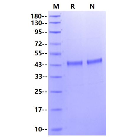 HRP-Labeled ATG4B His Tag Protein, Human – AntBio