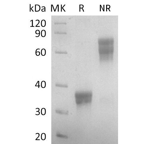 CD8 alpha&beta Heterodimer His Tag Protein, Human – ANT Bio