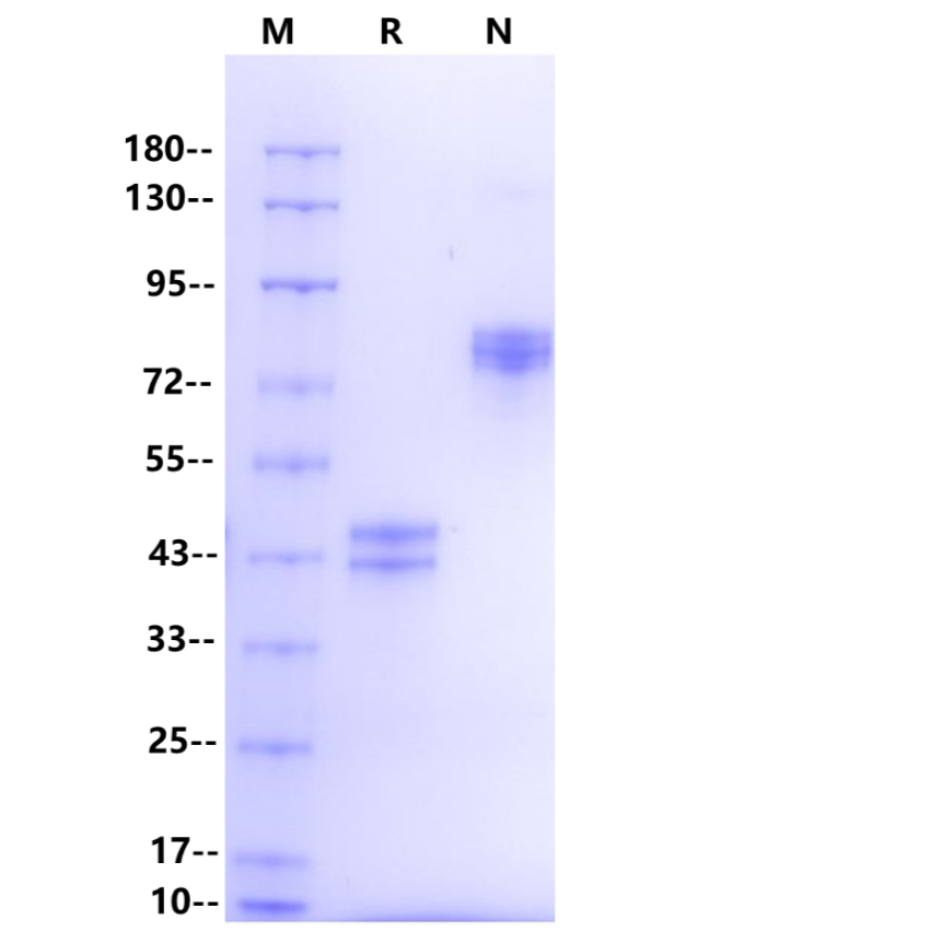 Complement/C5a Fc Chimera Protein, Human – AntBio